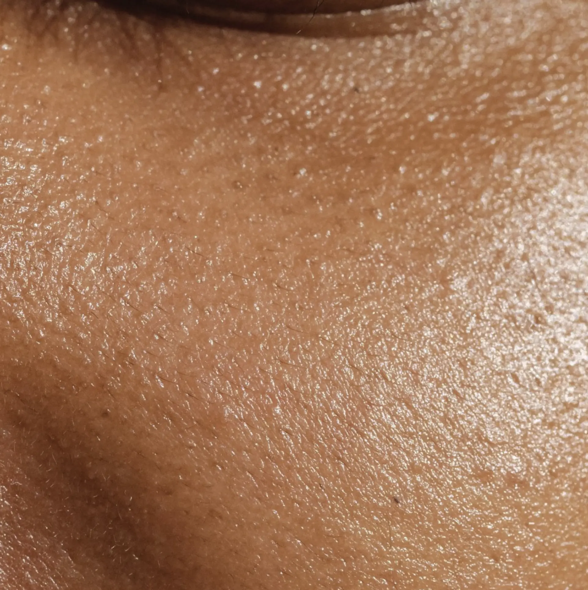 Why Do People Have Different Types Of Skin?